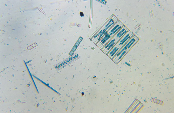 Protista