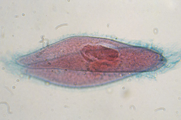 Protista