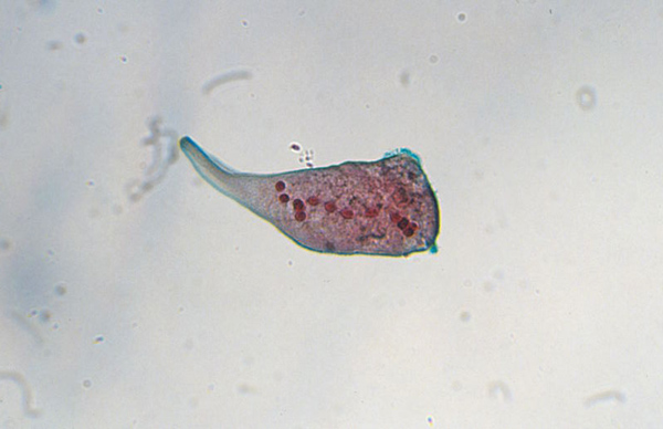 Protista