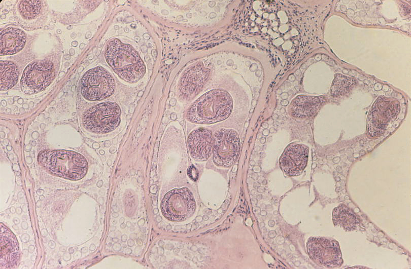 Monogeneans and Cestodes
