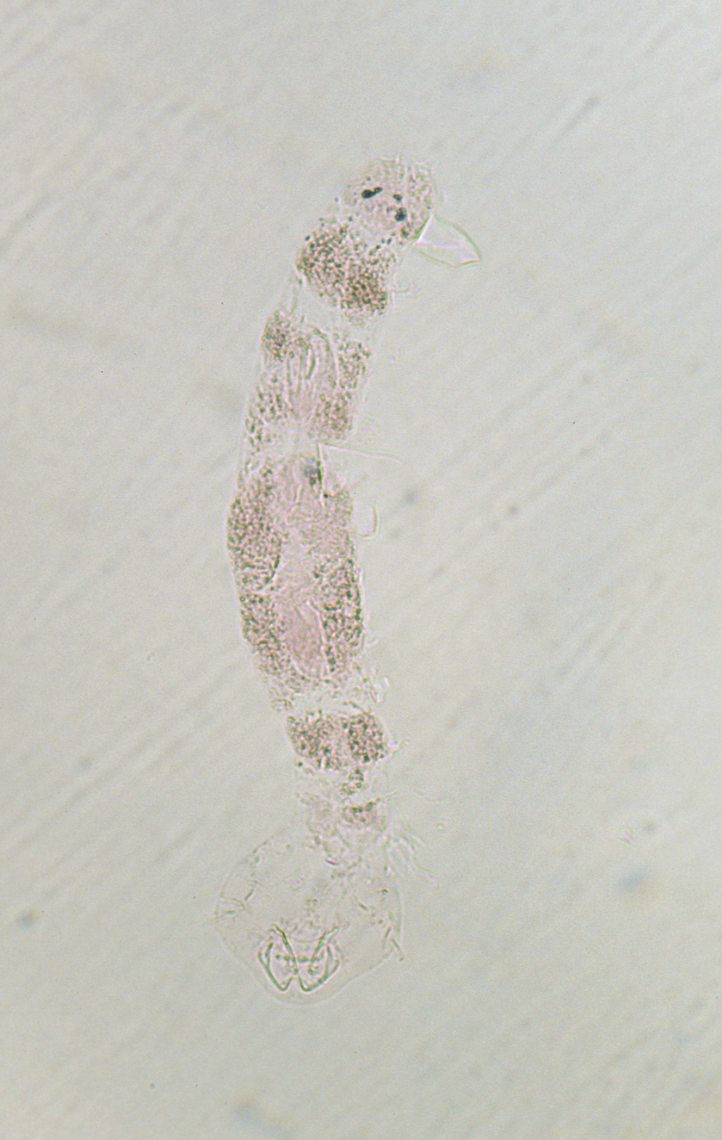 Monogeneans and Cestodes